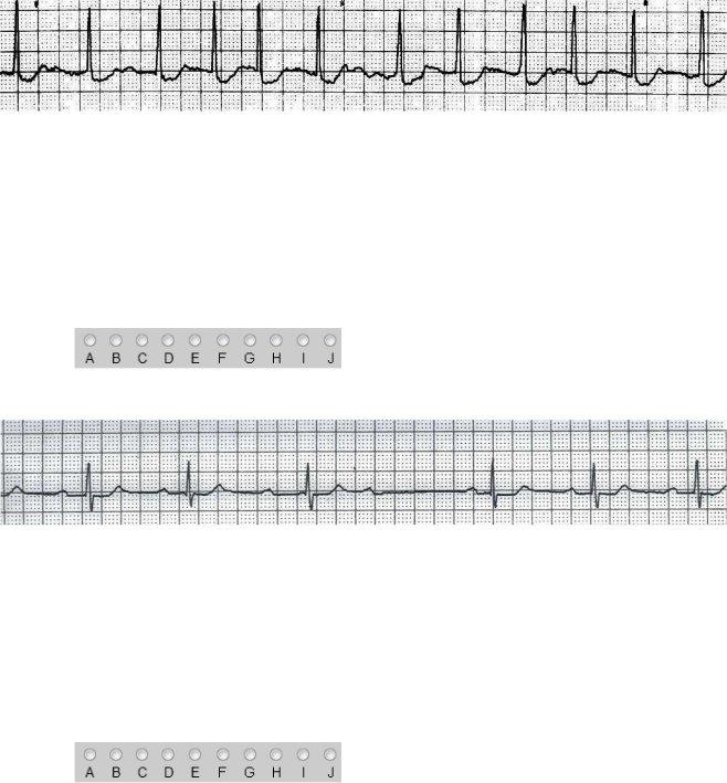Ekg Practice Form ≡ Fill Out Printable PDF Forms Online