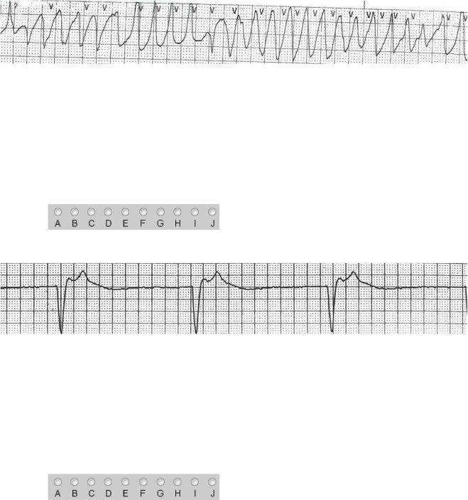 Ekg Practice Form ≡ Fill Out Printable PDF Forms Online