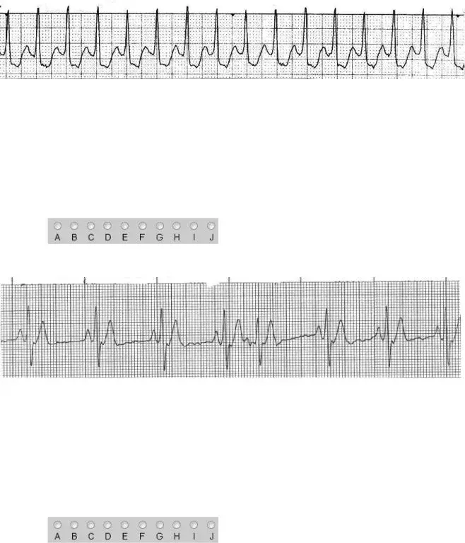Ekg Practice Form ≡ Fill Out Printable PDF Forms Online