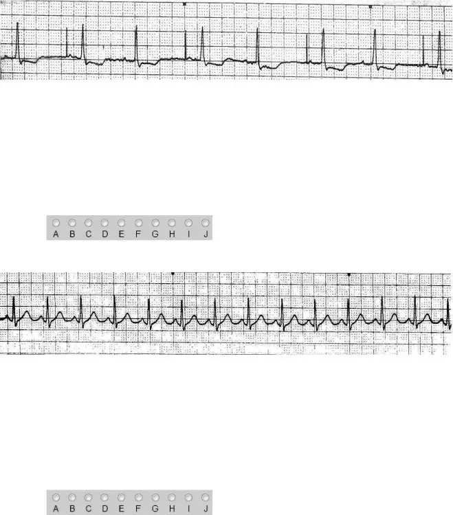 Ekg Practice Form ≡ Fill Out Printable PDF Forms Online