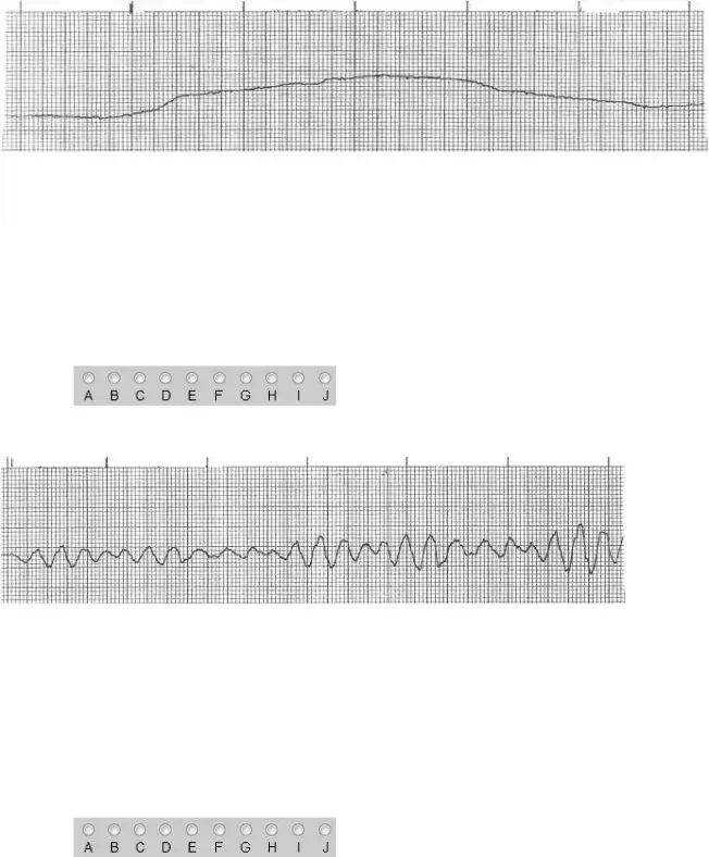 Ekg Practice Form ≡ Fill Out Printable PDF Forms Online