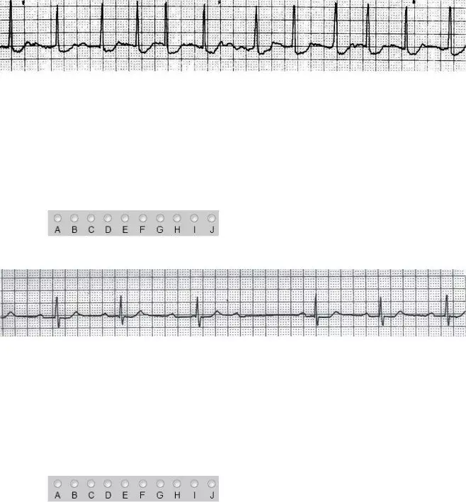 Ekg Practice Form ≡ Fill Out Printable PDF Forms Online